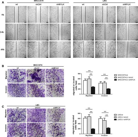 Knockdown Of Mylk Expression Inhibits Hcc Cell Motility And