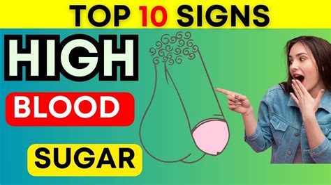 Alarming Signs Your Blood Sugar Is Too High Youtube
