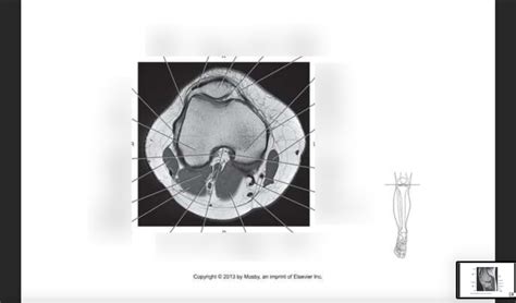Sectional Anatomy 54 Diagram Quizlet