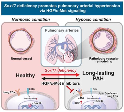 Genetic And Environmental Interaction Leads To Development Of Pulmonary