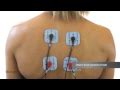 Comment Bien Positionner Les Lectrodes Sur Soi Tens Ems