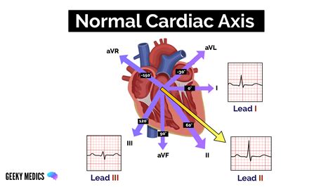 How To Read An ECG ECG Interpretation EKG Geeky Medics