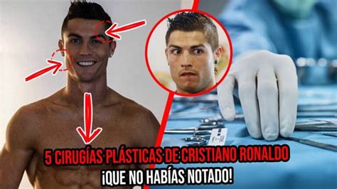 Cristiano Ronaldo Antes y después de su cirugía Revelamos su