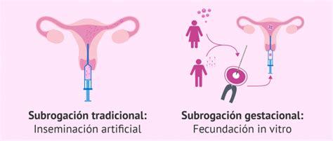 Cu Les Son Los Diferentes Tipos De Gestaci N Subrogada