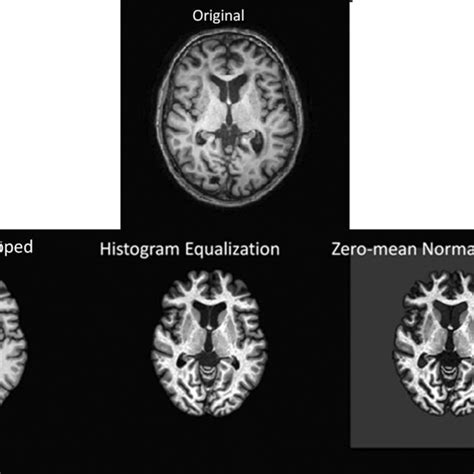 unet architecture for brain tissue segmentation download scientific diagram