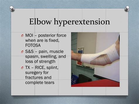 PPT Elbow Injuries PowerPoint Presentation ID 2188505