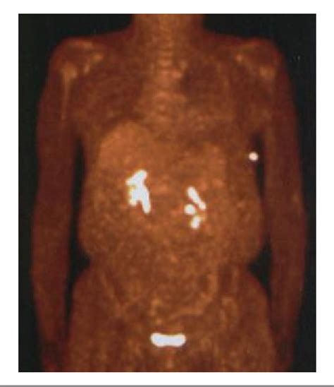 Figure 2 from Revisiting the ALA N α Lipoic Acid Low Dose Naltrexone