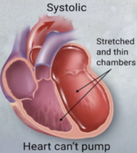 Cardiac Flashcards Quizlet