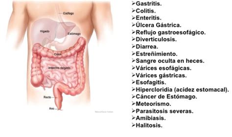Enfermedades Que Afectan El Sistema Digestivo Sistema Digestivo