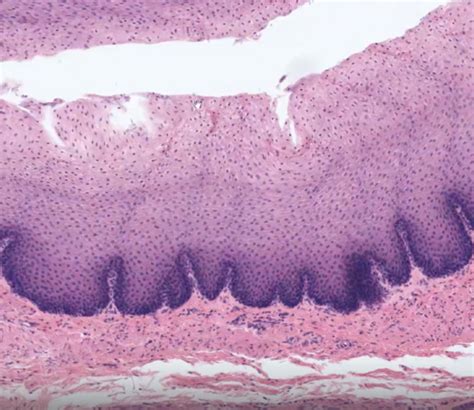 Histo Lab Exam 3 Flashcards Quizlet