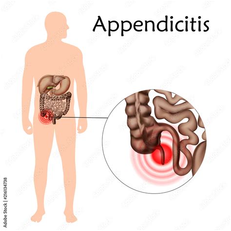 Anatomy Of Human Body Appendix