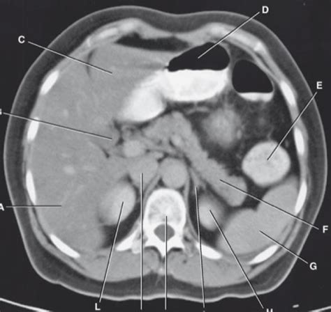 Transverse Abdomen 5 Diagram Quizlet