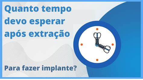 QUANTO TEMPO DEVO ESPERAR PARA FAZER MEU IMPLANTE APÓS A EXTRAÇÃO DO