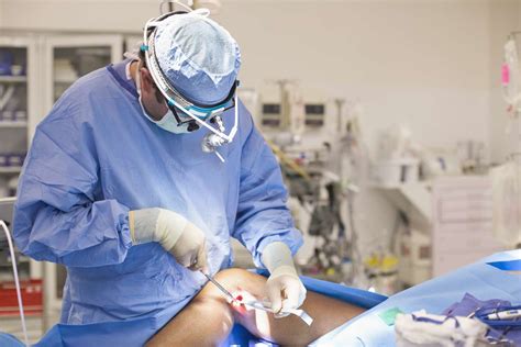 Knee Surgery Doctors