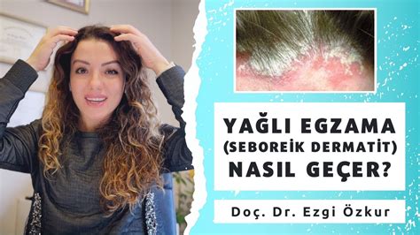 Yağlı Egzama Nasıl Geçer Seboreik Dermatit Tedavisi Dr Ezgi Özkur