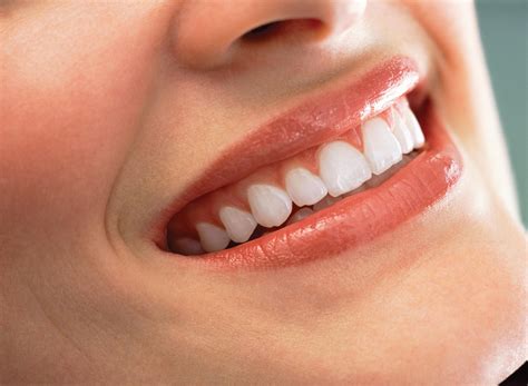 Mitos E Verdades Sobre O Clareamento Dental Essentia Odonto