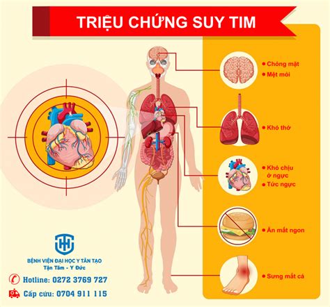Suy tim mạn tính Phương pháp chẩn đoán phòng ngừa và điều trị Bệnh