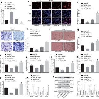 Overexpression Of MiR 367 Suppresses Proliferation Invasion And