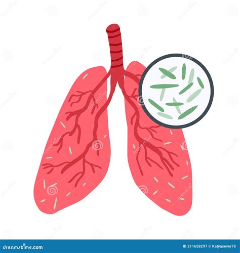 Pancarta Del Día Mundial De La Tuberculosis Pulmones Humanos