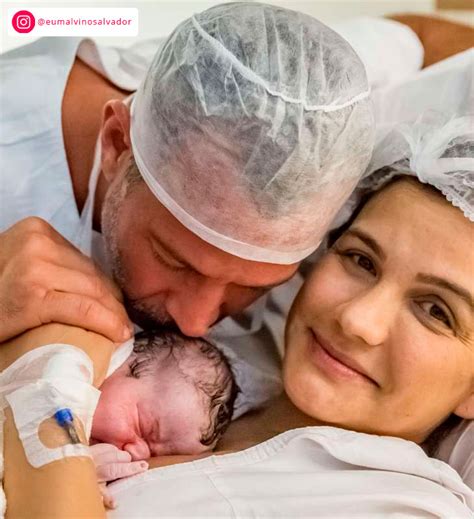 Malvino Salvador Mostra Antes E Depois De Transplante Capilar E