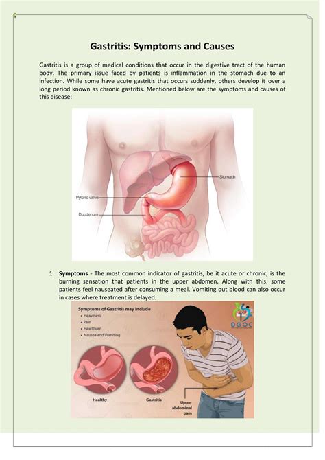 Gastritis Symptoms And Causes Pdf DocDroid