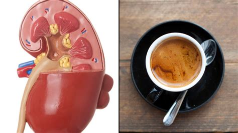 ᐈ Los efectos del café en la composición de la orina CaféSinMás