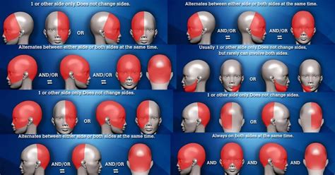 Location Of Headache Meaning And Headache Placement Meanings On