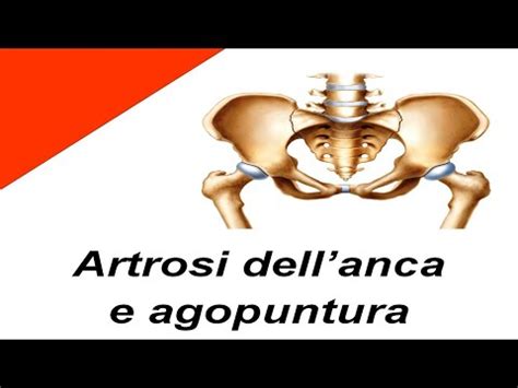 Artrosi Dell Anca E Agopuntura Coxartrosi E Agopuntura Dolore Dell
