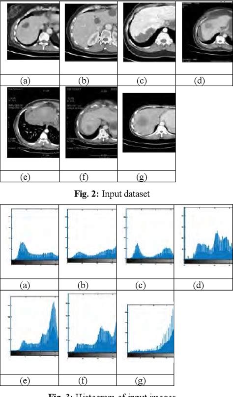 figure 2 from the dicom ct image compression based on enhanced lossless prediction and