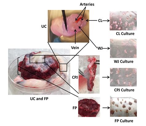 Isolation And Characterization Of Mesenchymal Stromal Cells From Human