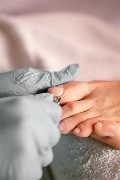 Non Invasive Ingrown Toenail Treatments Best NYC Foot Surgeon