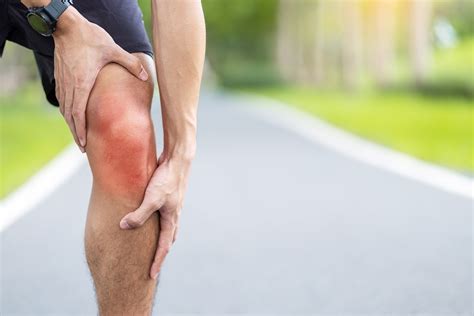 Tendinitis rotuliana Causas síntomas y tratamiento Fisiocrem