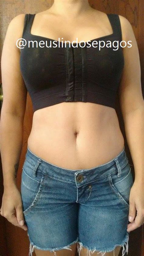 Meus Lindos e Pagos Arquivos Abdominoplastia Lipoaspiração
