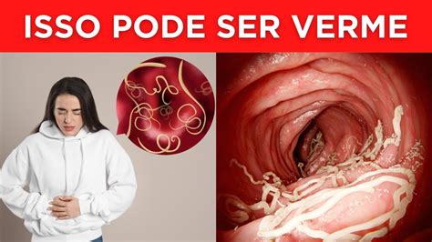 Não Ignore esses Sintomas Iniciais de Parasitas no seu Organismo Pode