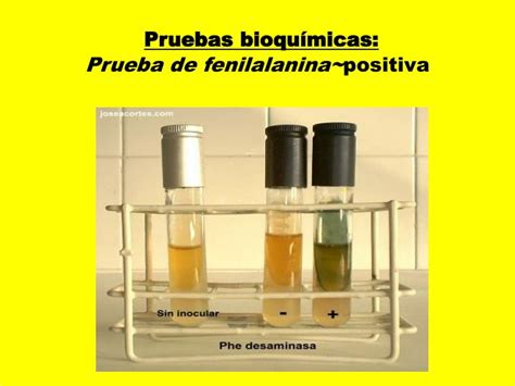 Ppt Pruebas Bioqu Micas O F Metabolismo Oxidativo Powerpoint