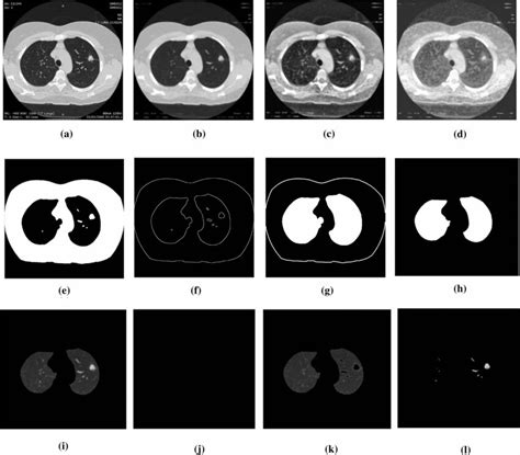 segmentation results of approach ii thresholding k means download scientific diagram