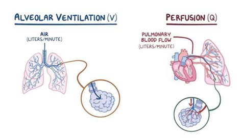 Ventilation Perfusion Relationships And V Q Defects Flashcards Quizlet