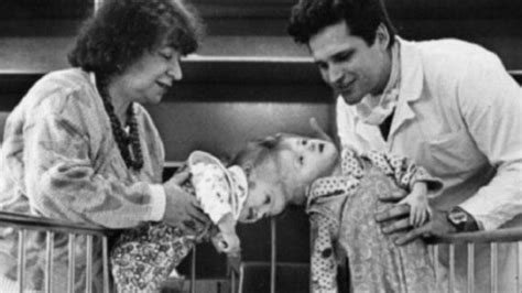 Guarda Come Sono Oggi Le Due Gemelle Siamesi Separate Nel 1989