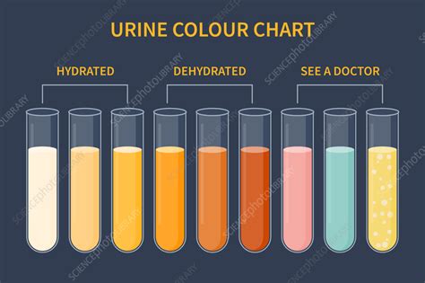 Urine Colour Chart Illustration Stock Image F037 3595 Science