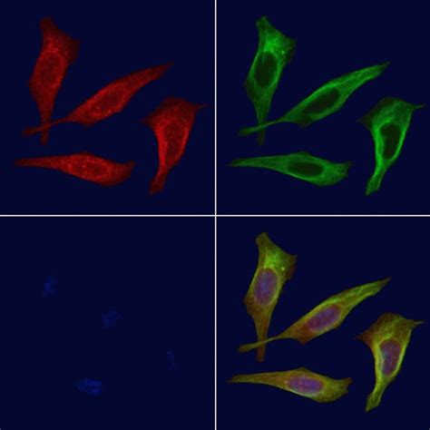 Phospho ROCK1 Tyr913 Polyclonal Antibody Invitrogen 100 μL