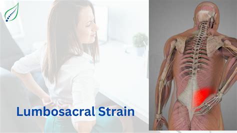Lumbosacral Strain Causes Symptoms Treatment Best Back Pain Slip
