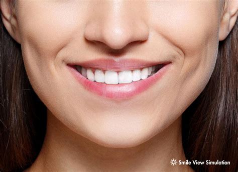 Clínica Mariana Sacoto Ortodoncia Invisalign Barcelona