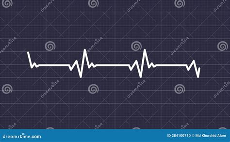 Heartbeat Pulse Rate Animation With Grid Background Electrocardiogram