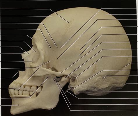 Rohen Images Osteology Block Image Skull Left Lateral View