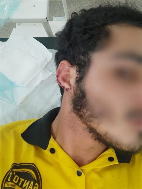 Vídeo funcionário de lanchonete tem orelha mordida e arrancada por