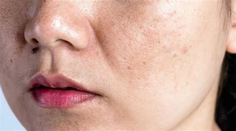 Ini Penyebab Wajah Kusam Walau Sudah Memakai Skincare Teropong Media