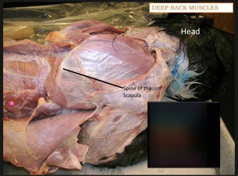Deep Back Muscles Diagram Quizlet
