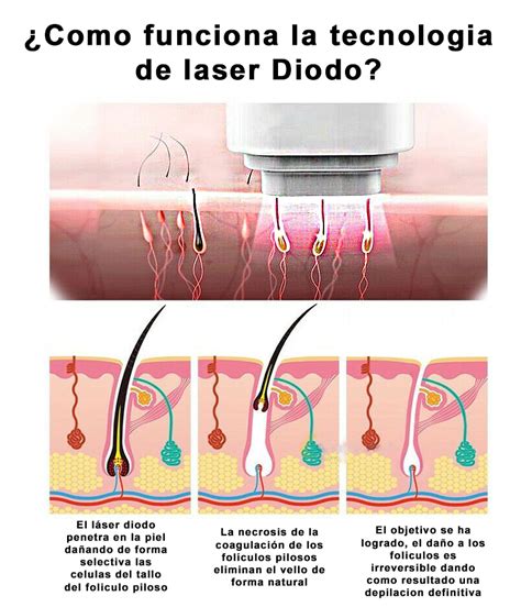 Laser Diodo 808nm Tres Longitudes De Onda 755nm 808nm 1064nm Para