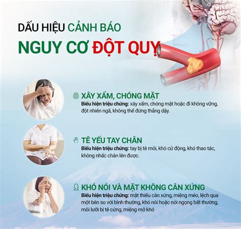 Triệu chứng sớm của đột quỵ Dấu hiệu nhận biết để phòng ngừa hiệu quả