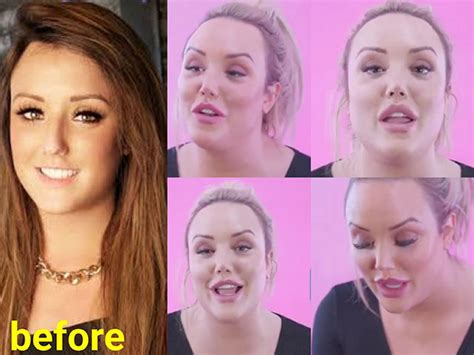 19 People Who Took Plastic Surgery Way Too Far Wtf Gallery EBaum S